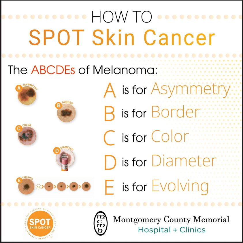 Early Detection of Skin Cancer
